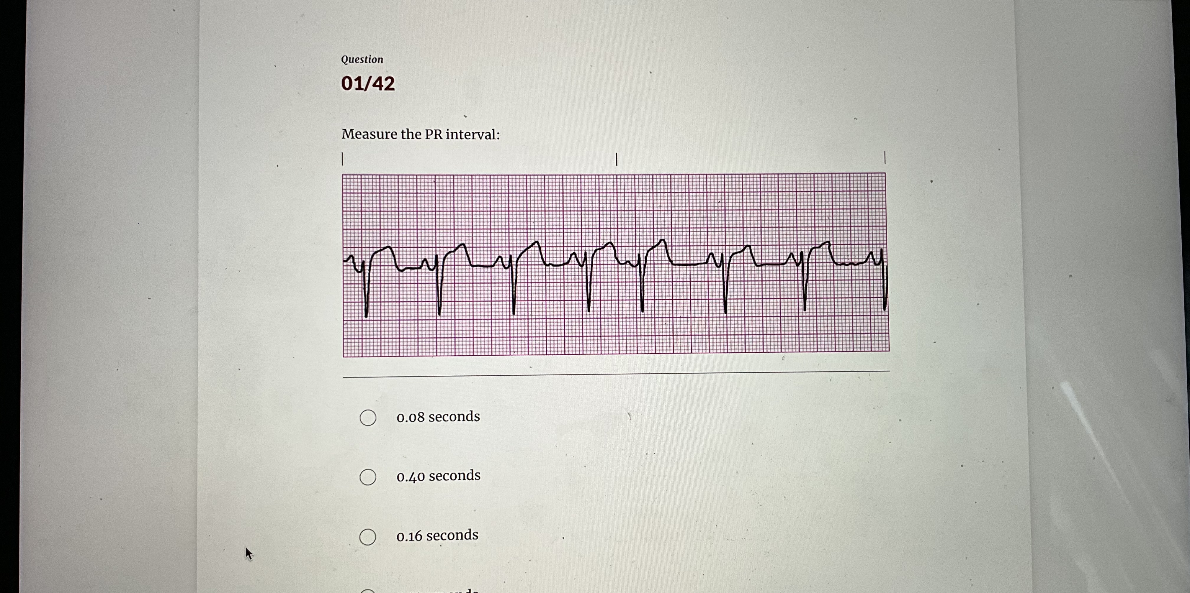 Solved Measure the PR interval: 0.08 ﻿seconds 0.40 ﻿seconds | Chegg.com