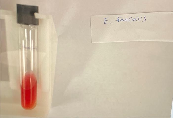 Solved PART B: Methyl Red Test and Voges-Proskauer Test | Chegg.com