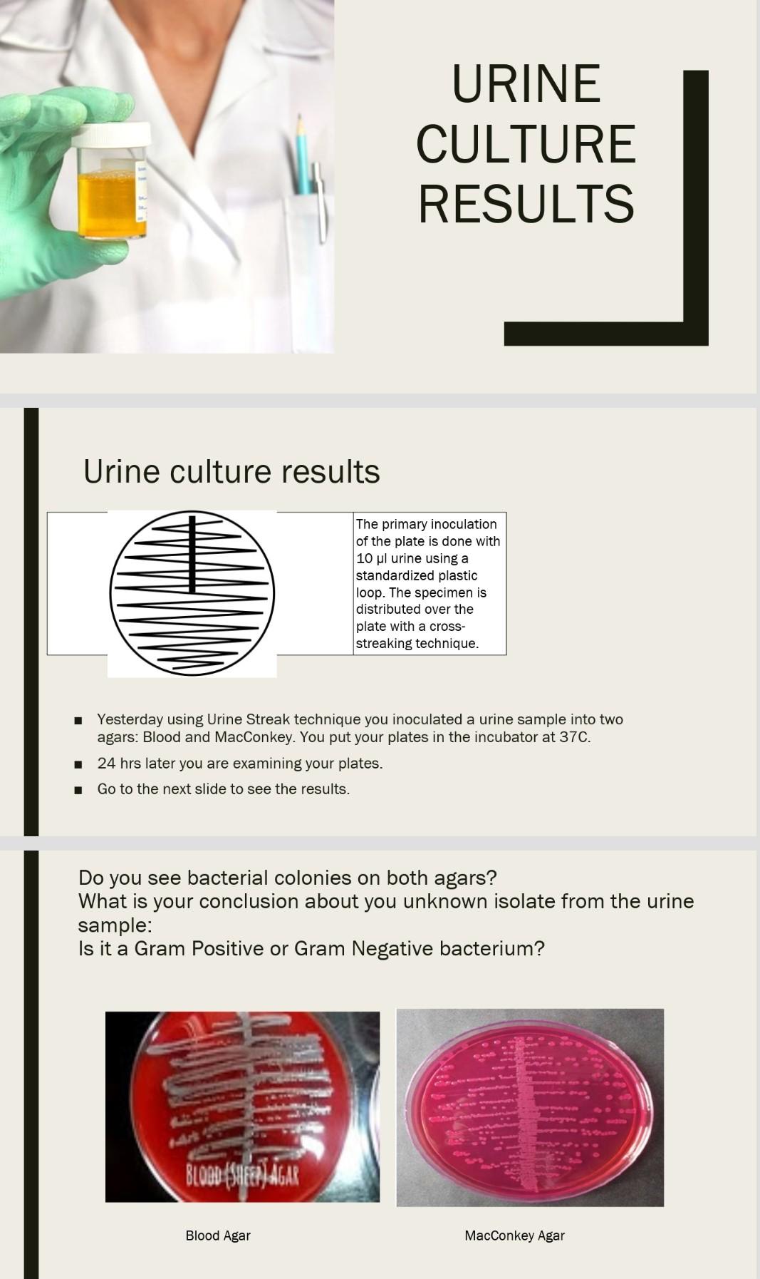 Solved URINE CULTURE RESULTS Urine culture results The | Chegg.com