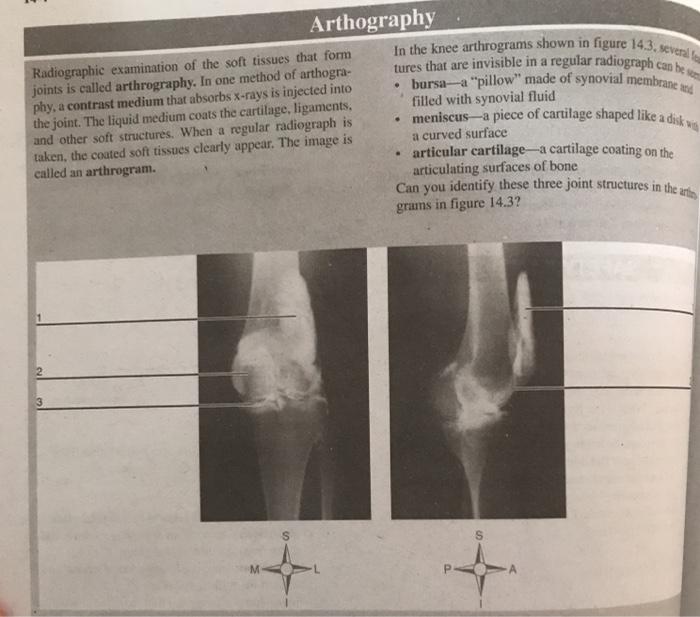Solved In the knee arthrograms shown in figure 14.3. several | Chegg.com
