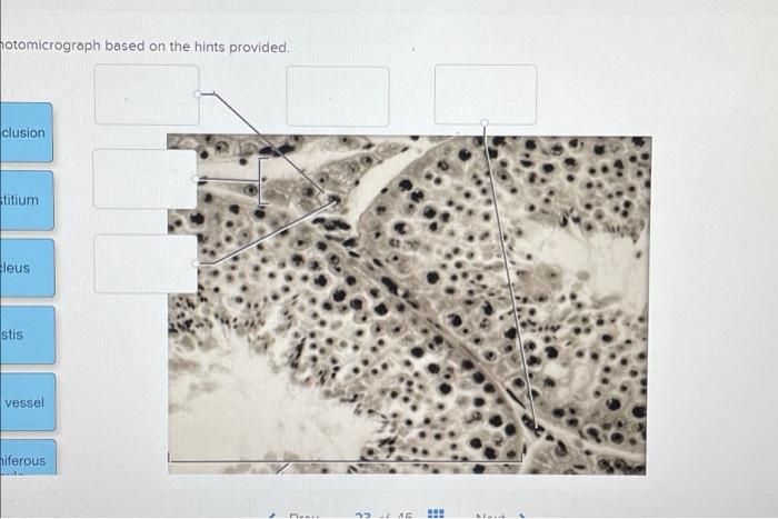 Solved hotomicrograph based on the hints provided. | Chegg.com