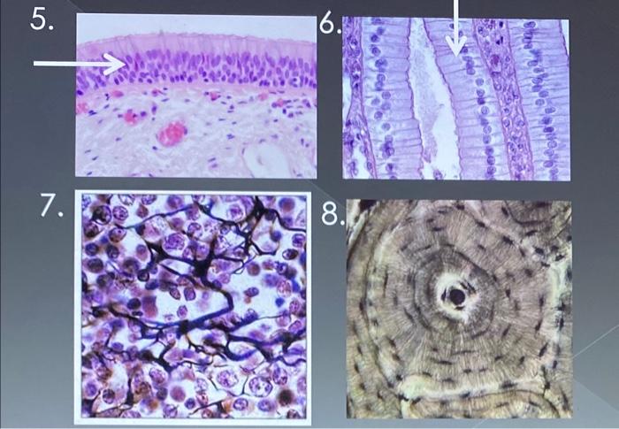Solved 9. Tissue indicated by the pointer 10. 11. | Chegg.com