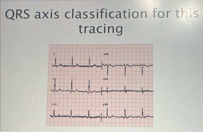Solved QRS axis classification for this tracing مسلسلسل | Chegg.com