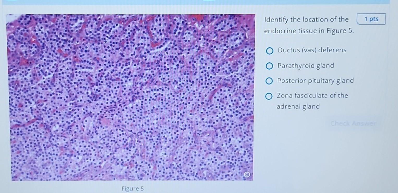 Solved What hormone is produced by the gland in Figure 2? | Chegg.com