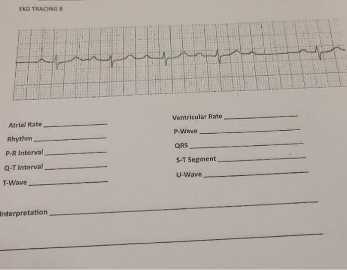 Solved EKG TRACING B Atrial Rate Rhythm P-R Interval Q-T | Chegg.com