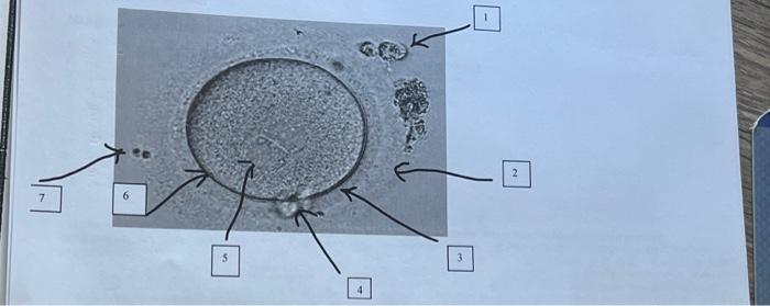 Solved What is each labeled part of this oocyte. using | Chegg.com