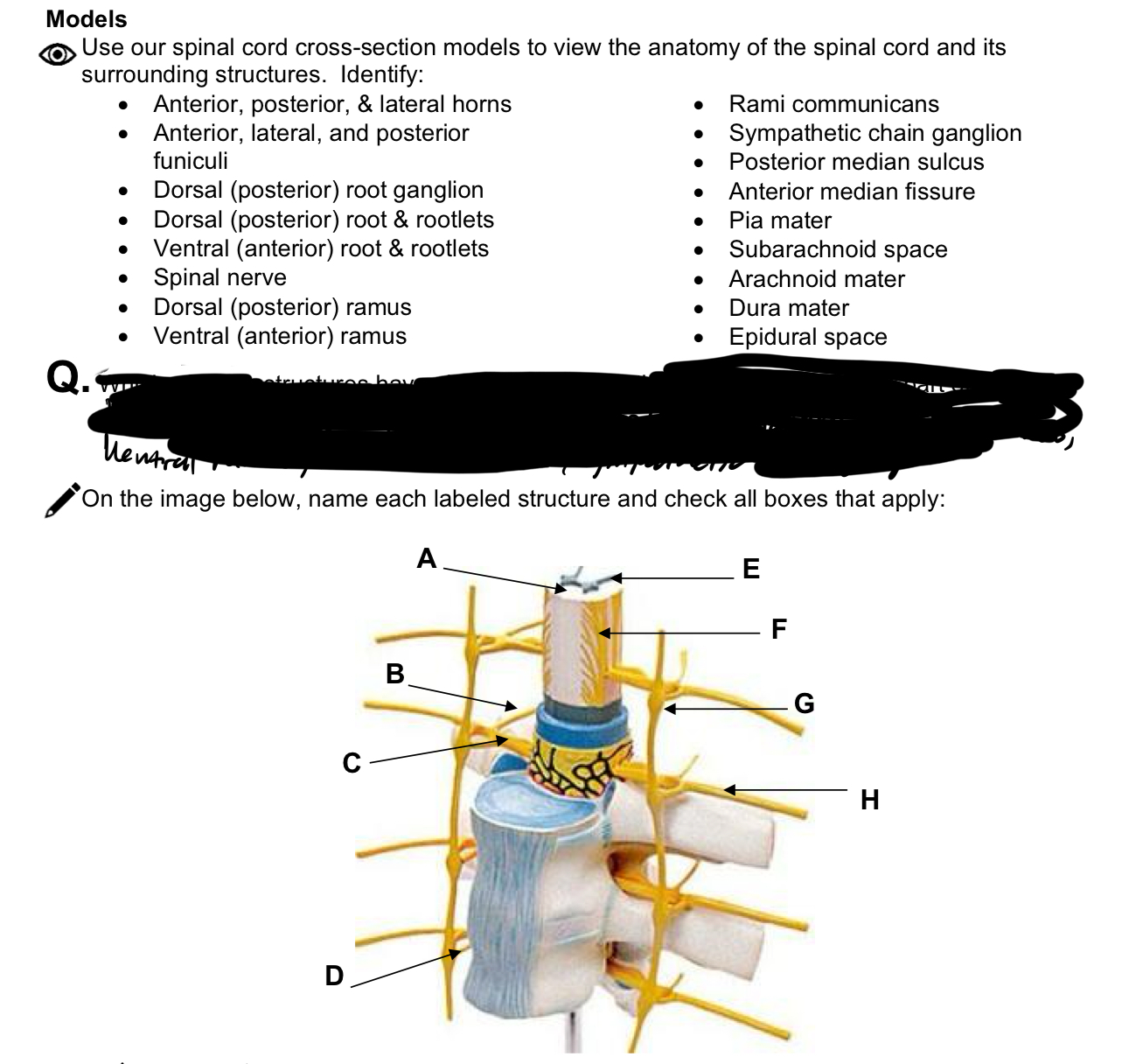 Solved (1) ﻿Use our spinal cord cross-section models to view | Chegg.com
