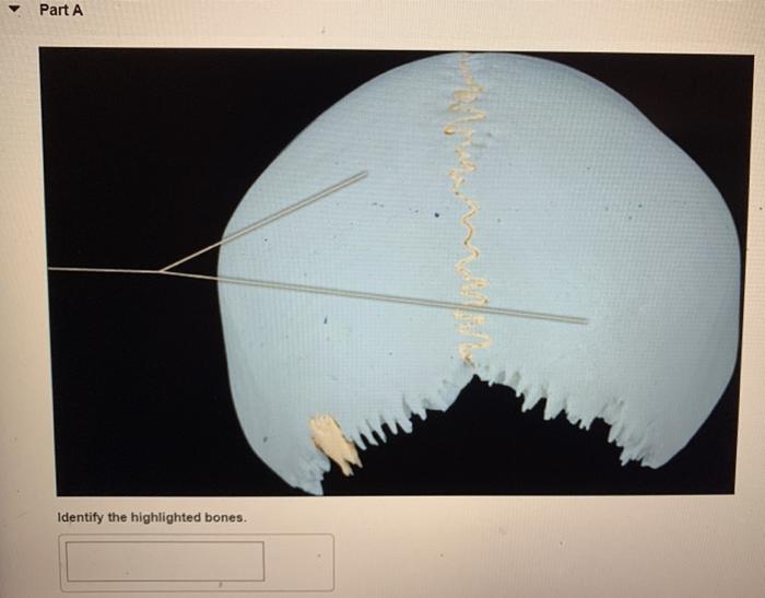 Solved Part A Identify the highlighted bones. Identify the | Chegg.com