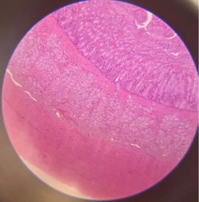 Solved label onto photo: mucosa, submucosa, lamina propria, | Chegg.com