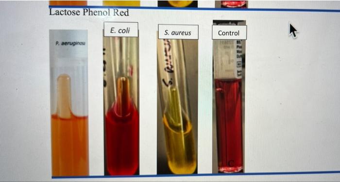 Solved RESULTS AND INTERPRETATIONS (Out of 6 points) Glucose | Chegg.com