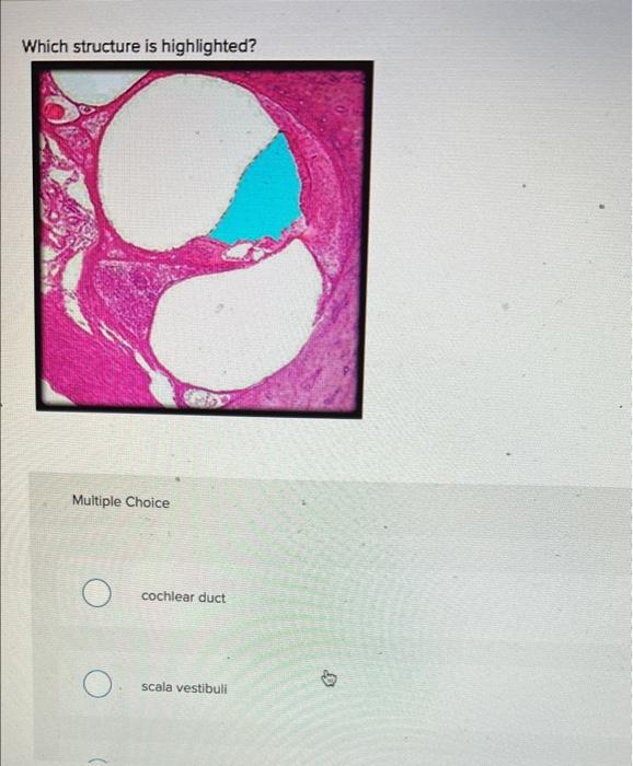 Solved Which structure is highlighted? Multiple Choice О | Chegg.com