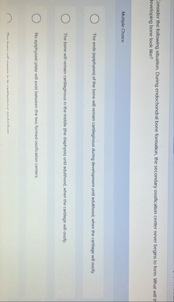 Solved Consider the following situation. During endochondral | Chegg.com