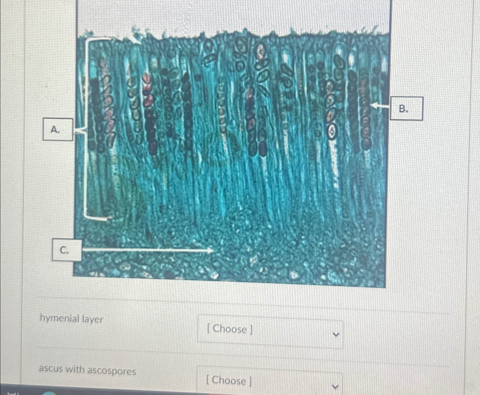 Solved label these 3:hymenial layerascus with | Chegg.com
