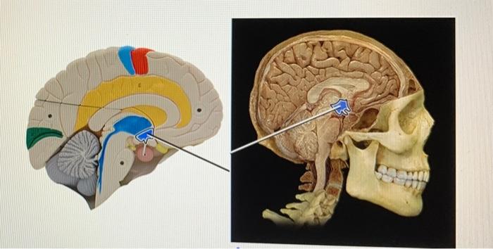 Solved Which structure is highlighted and indicated by | Chegg.com