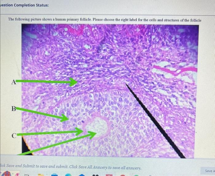 Solved Fertilization envelope is formed during. to block 1. | Chegg.com