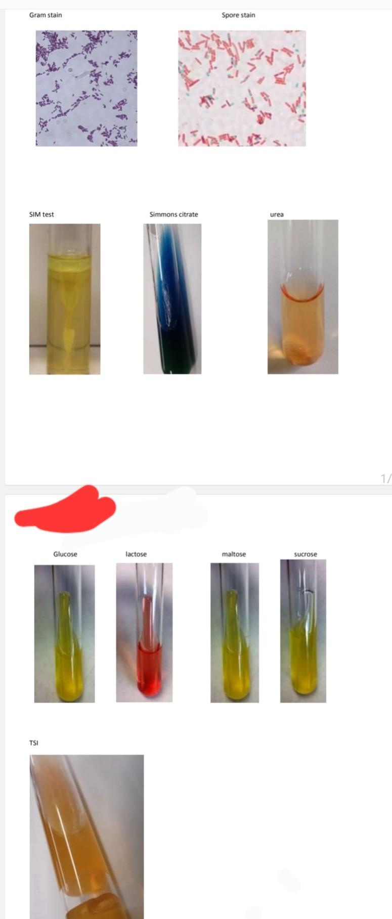 Solved Gram stain Spore stain श SIM test Simmons citrate | Chegg.com