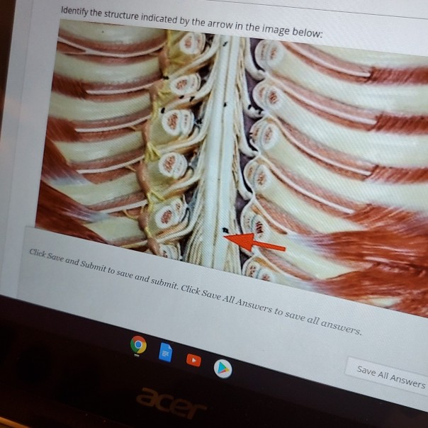 Solved Identify the structure indicated by the arrow in the | Chegg.com