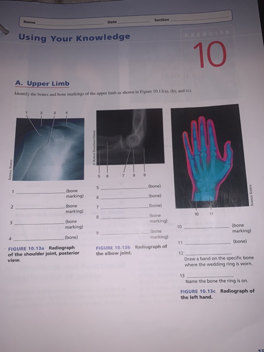 Solved Name Date Section Using Your Knowledge A. Upper Limb | Chegg.com