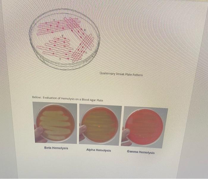 Week 2 Laboratory Manual Information: Aseptic | Chegg.com