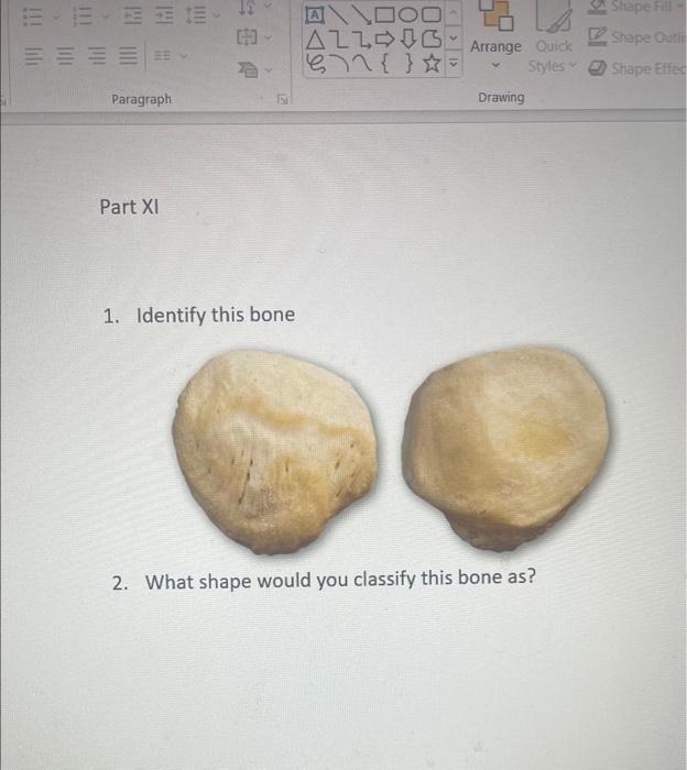 Solved Part XI 1. Identify this bone 2. What shape would you | Chegg.com