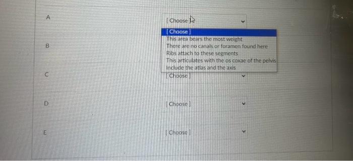 Solved Using trie rigure berow, match the roliowing: A | Chegg.com