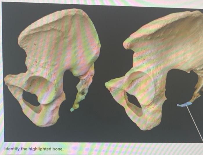 Solved Identify the highlighted structures. Name the type | Chegg.com