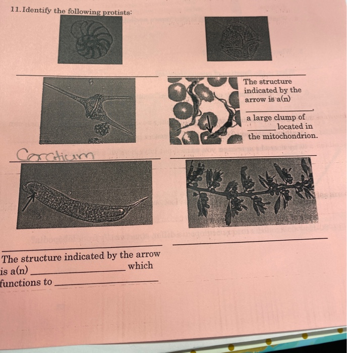 Solved 11. Identify the following protists: The structure | Chegg.com
