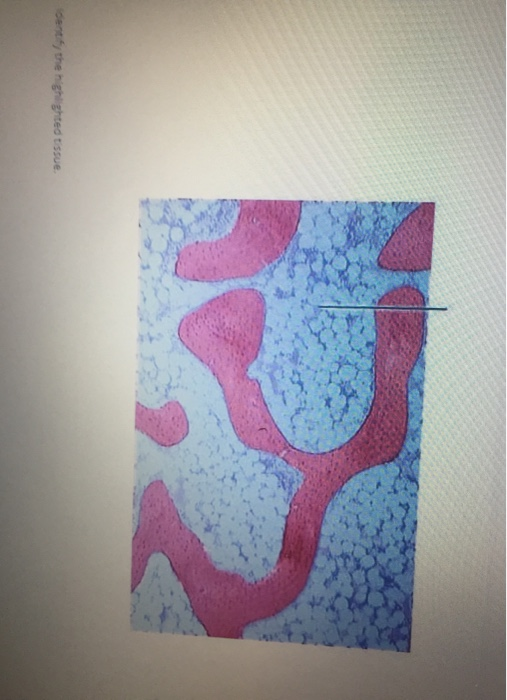 Solved dentify the highlighted tissue. | Chegg.com Solved dentify the highlighted tissue. | Chegg.com