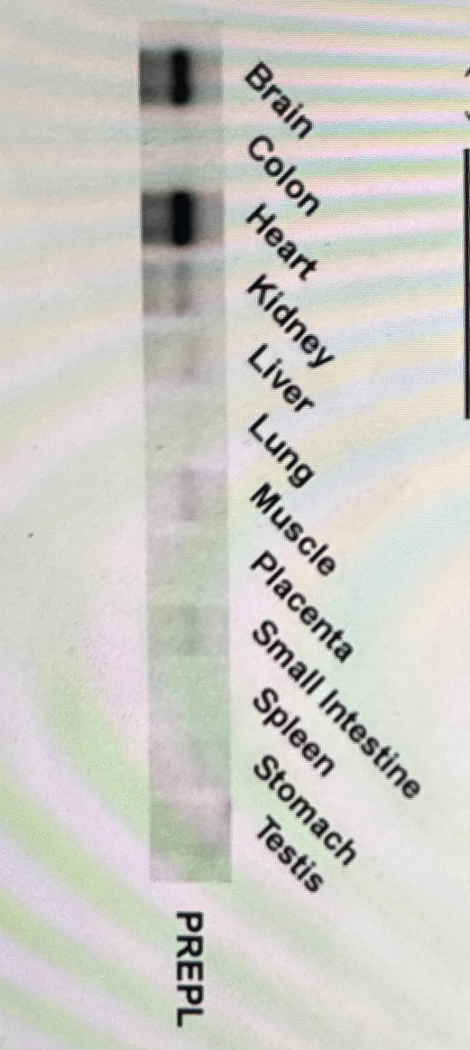 Solved (b) ﻿Discuss all the results for this Northern Blot | Chegg.com