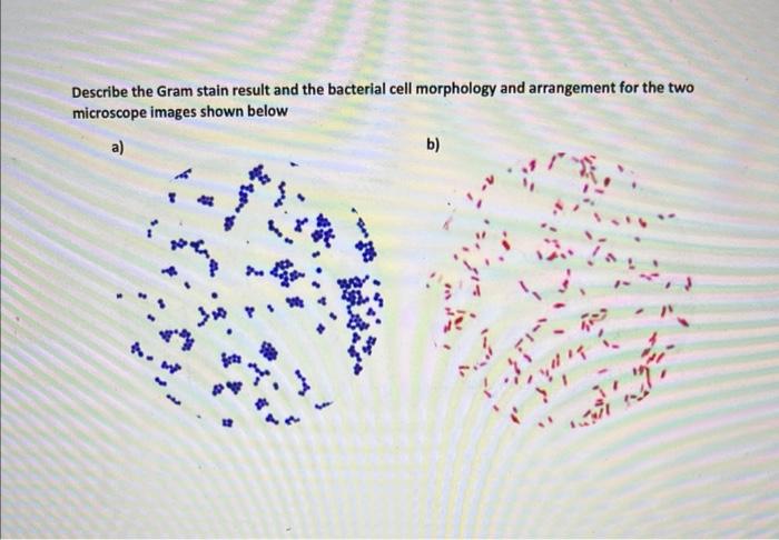 Solved Describe the Gram stain result and the bacterial cell | Chegg.com