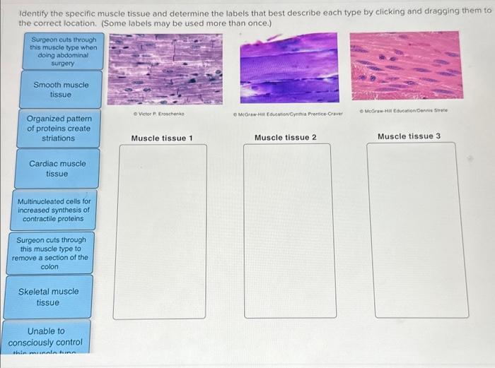 Identify the specific muscle tissue and determine the | Chegg.com Identify the specific muscle tissue and determine the | Chegg.com