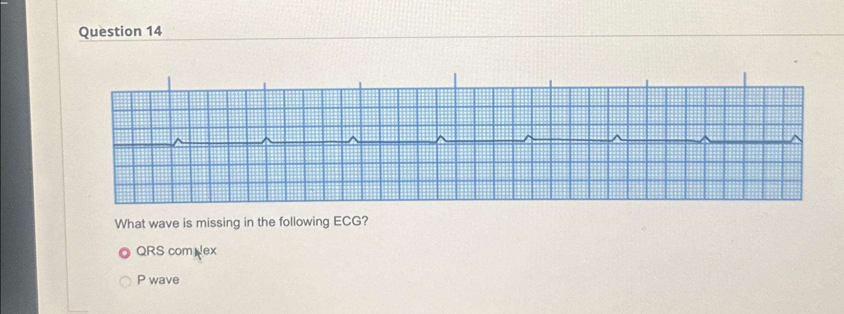 Solved Question 14What wave is missing in the following | Chegg.com