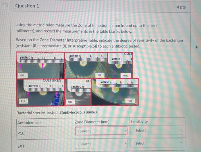 Solved Using the metric ruler, measure the Zone of | Chegg.com
