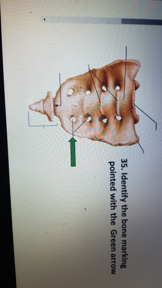 Solved QuCJIUN 2+1 pun) 32. Identify the structure pointed | Chegg.com
