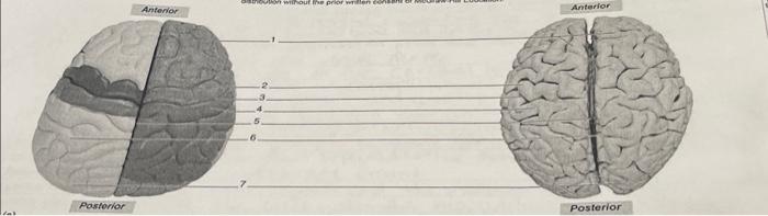 Solved what part of the brain is the number/ line 6 | Chegg.com