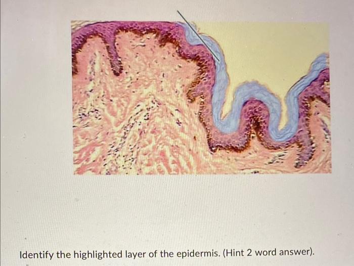 Solved Identify the highlighted layer of the epidermis. | Chegg.com