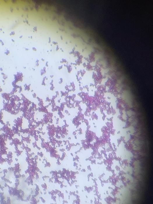 Solved Based on the quad streak and gram stain pictures, | Chegg.com