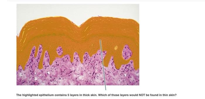 Solved The highlighted epithelium contains 5 layers in thick | Chegg.com