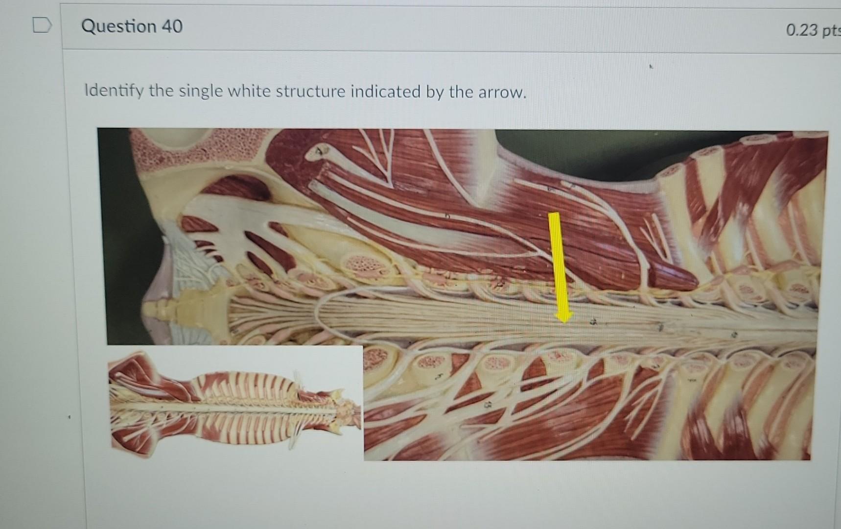Solved Identify the structure at the tip of the | Chegg.com