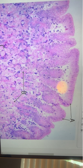 19 20 Wis Use the exact terms in your V-Scope | Chegg.com
