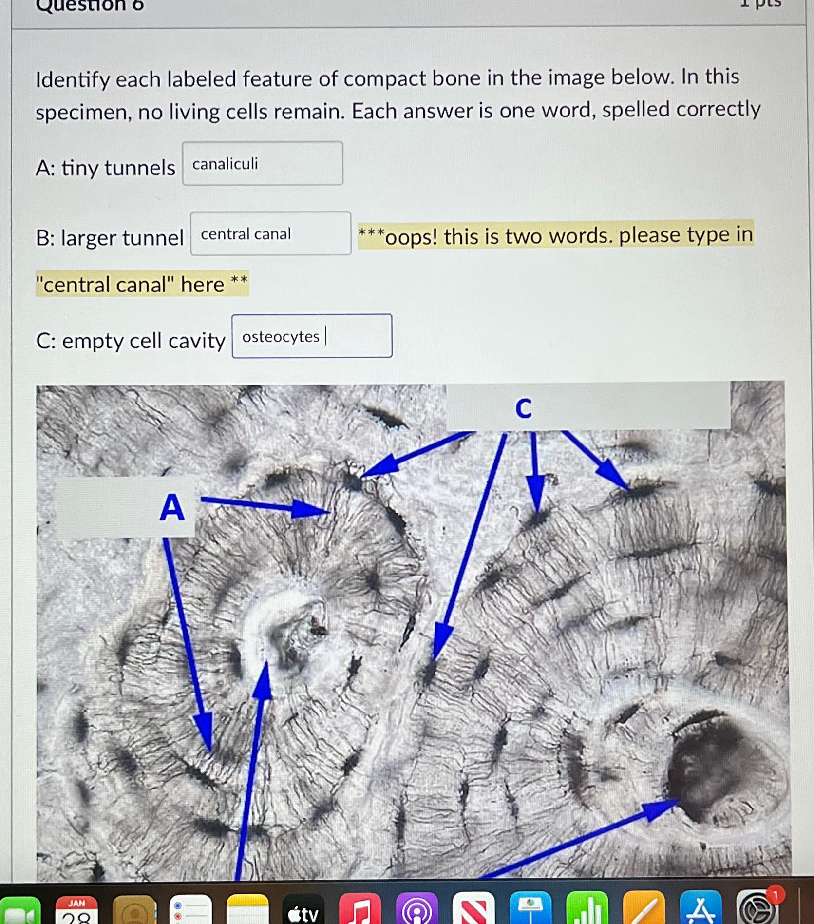 Solved Identify each labeled feature of compact bone in the | Chegg.com