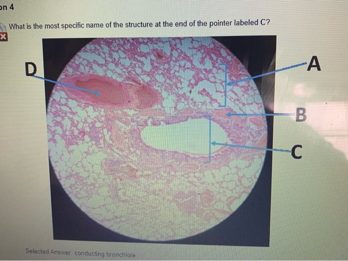 Solved label alllabel a b c and d | Chegg.com