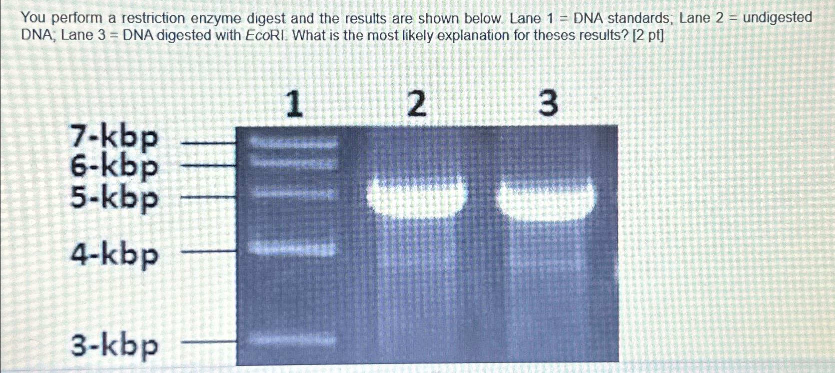 Solved You Perform A Restriction Enzyme Digest And The