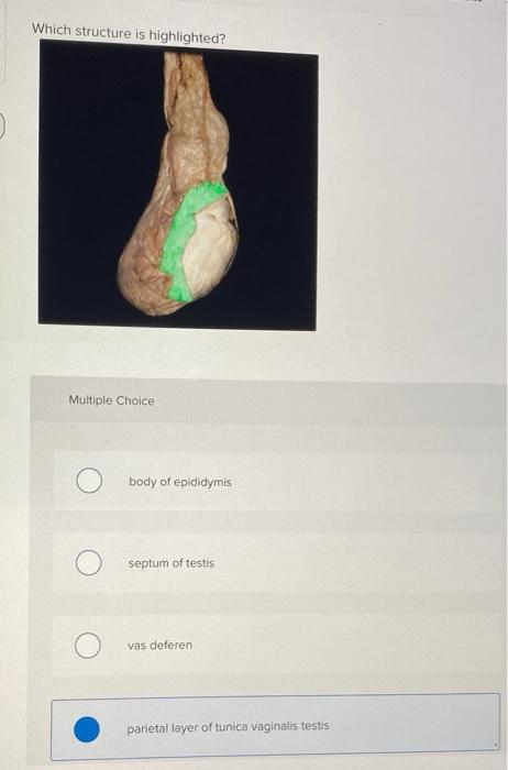 Solved Which structure is hiahliahteri? Multiple Choice body | Chegg.com