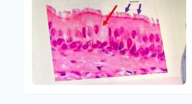 Solved Identify this structur and the type of epithelium | Chegg.com
