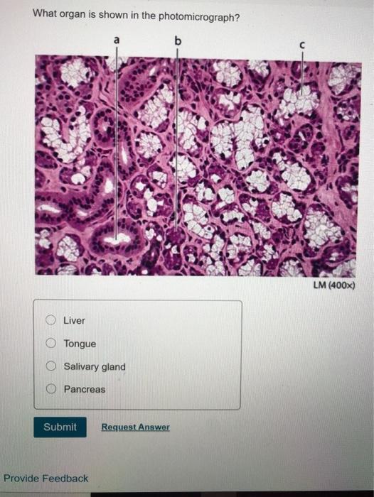 Solved What organ is shown in the photomicrograph? b LM | Chegg.com