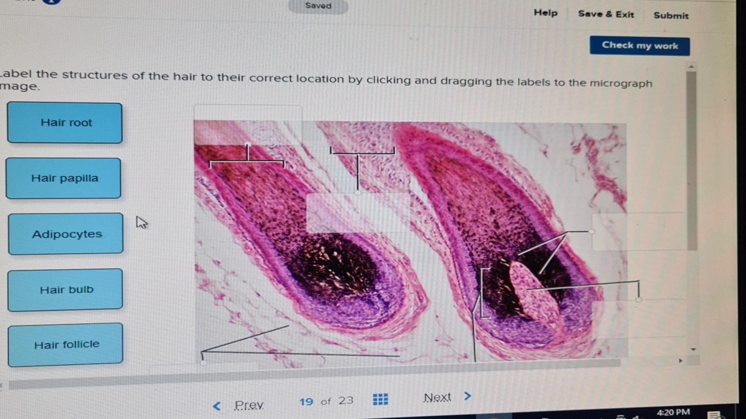Solved Saved Help Save & Exit Submit Check my work Label the | Chegg.com