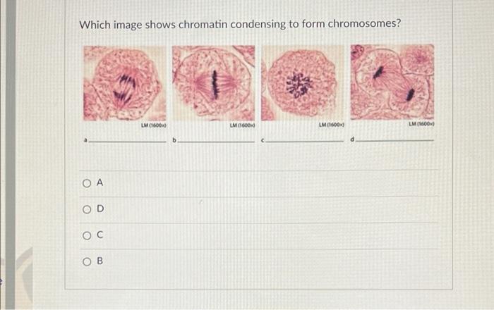 Solved Which image shows chromatin condensing to form | Chegg.com