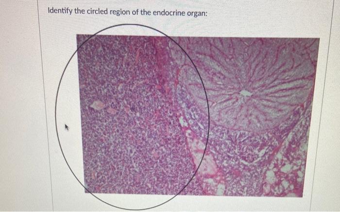 Solved Identify the circled region of the endocrine organ: | Chegg.com