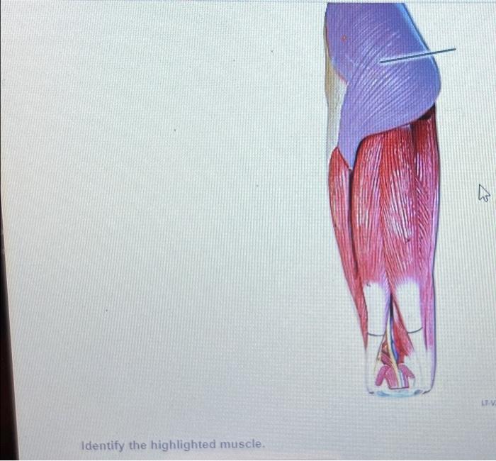 Solved Identify the highlighted muscle. | Chegg.com
